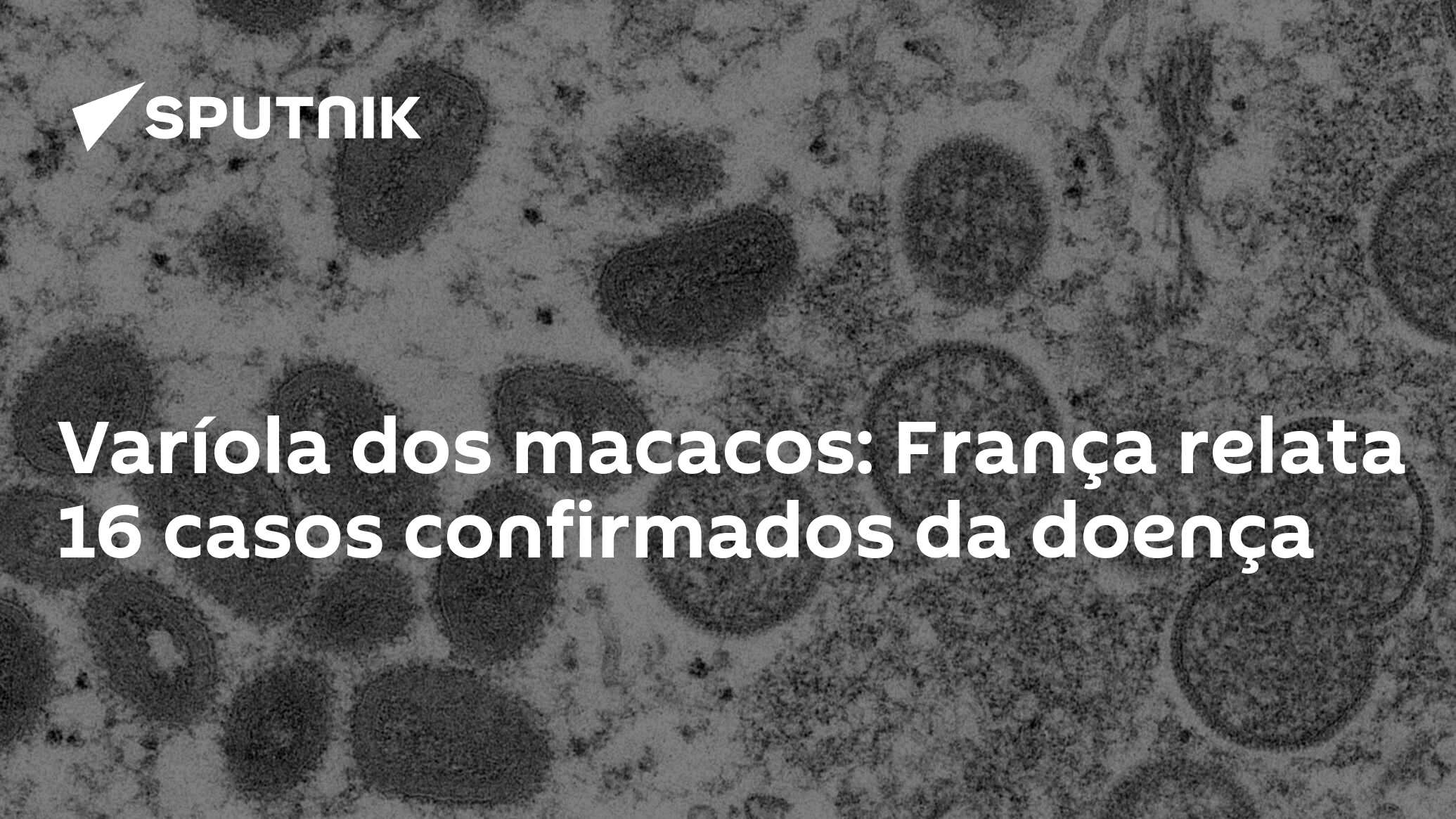 Varíola dos macacos: França relata 16 casos confirmados da doença - 29. ...